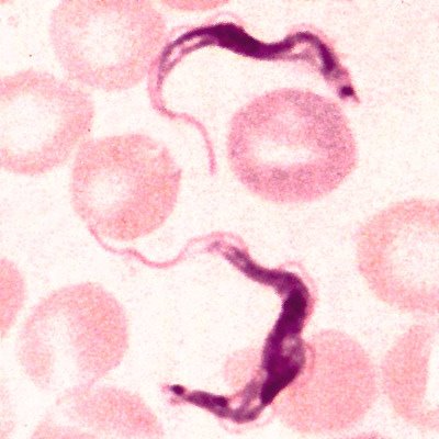 Parasitología: Trypanosoma cruzi
